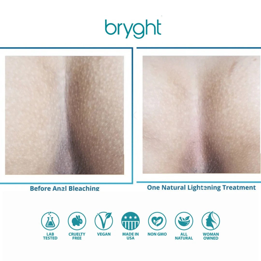 Bleached Butthole Before And After Anal Bleach Bundle The Booty