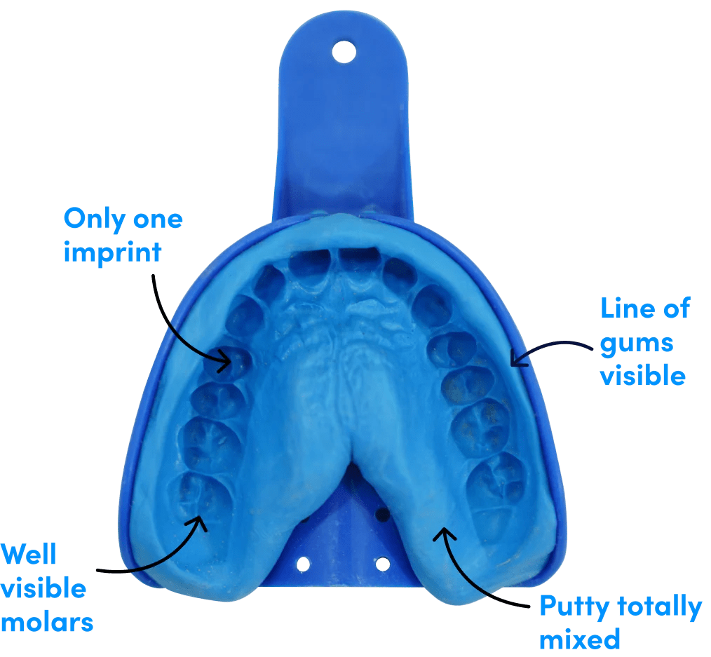 How To Take Impression Caspersmile