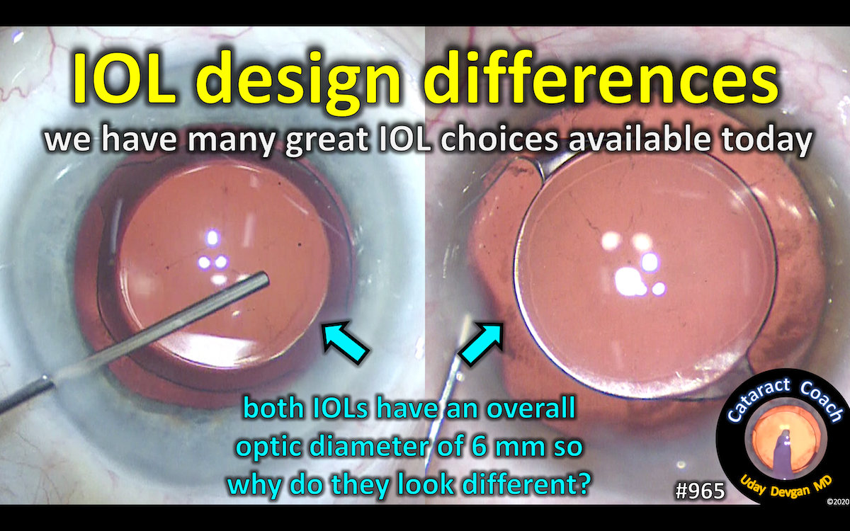 IOL design differences – Cataract Coach