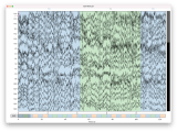 Visualizing Eeg Data Clemens Brunner