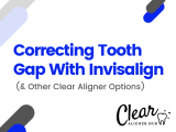Fixing Tooth Gaps With Invisalign Other Clear Aligners