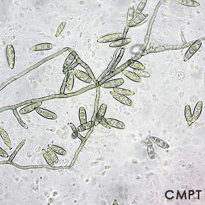 Bipolaris_opt2 | cmpt