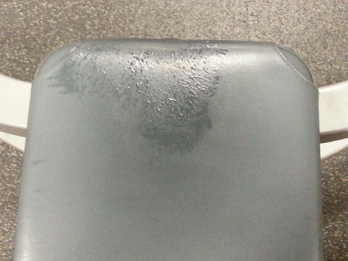 Watch Out For These Ridiculous Gym Diseases You Can Get In The Gym