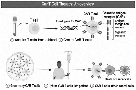 CAR-T cell therapy: The future mainstay of cancer treatments - Rau's IAS