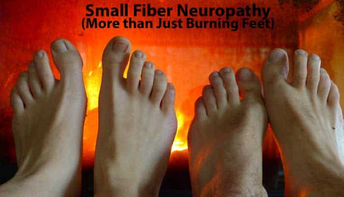 What is Small Fiber Neuropathy - Counting My Spoons