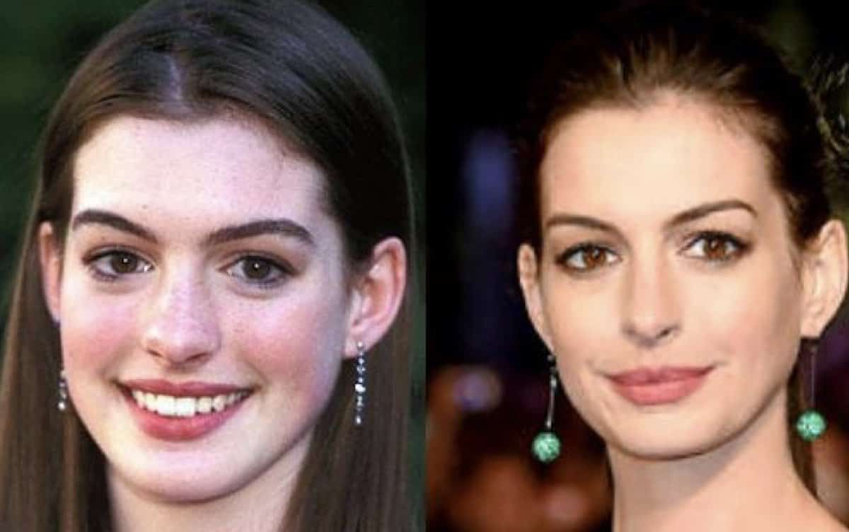 25 fotos del antes y después de Anne Hathaway - Cultura Colectiva