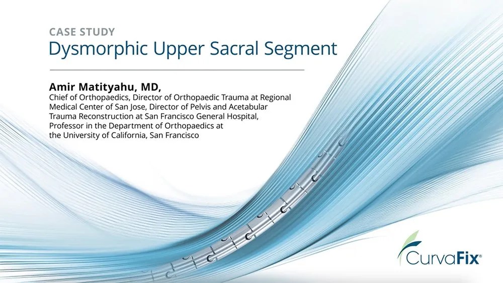 Case Study: Dysmorphic Upper Sacral Segment - CurvaFix