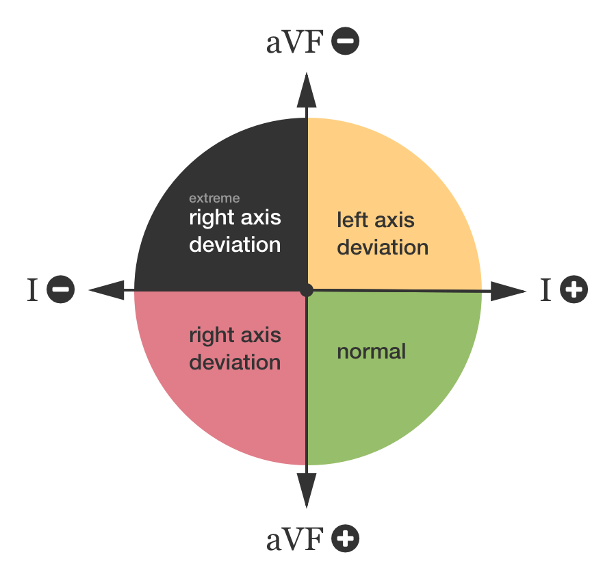 ECG / EKG; Types, Indications/Uses, Procedures, Results - illnesshacker