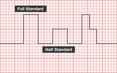 ECG / EKG; Types, Indications/Uses, Procedures, Results - illnesshacker
