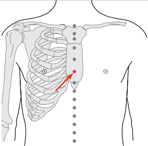 Acupressure points for Stress and Anxiety - Debbie Lee