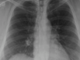 Share Your Science The Impact Of Deep Learning On Radiology Nvidia