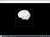 Brainmap Devyansh Gupta