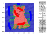 Interactive Graph Cut Image Segmentation