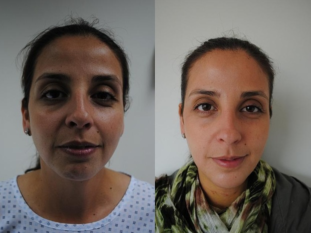 Dr. Diego Polanco | Consultas en La Serena y Santiago