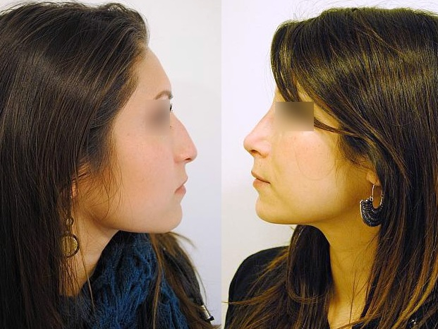 Dr. Diego Polanco | Consultas en La Serena y Santiago