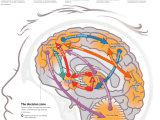 Adhd And Brain Direct