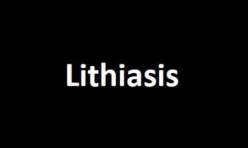 Lithiasis (Litiazis) Nedir? • Doktordan Haberler
