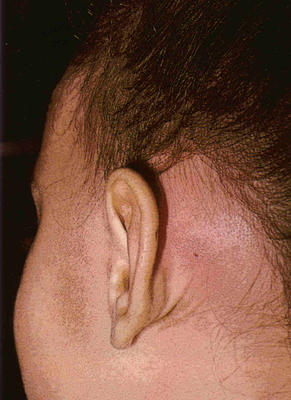 ENT Part 1: a word in your ear