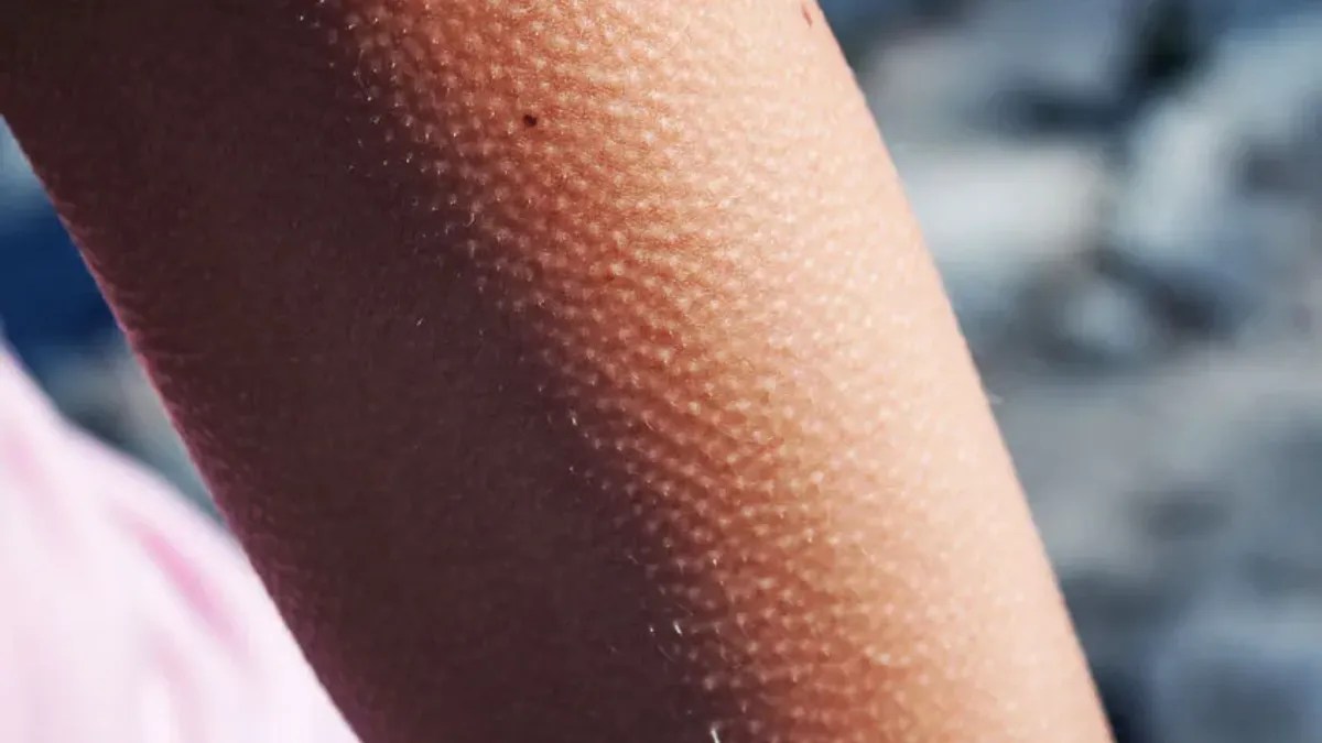 What is the Pilomotor Reflex? – Doyle's Space