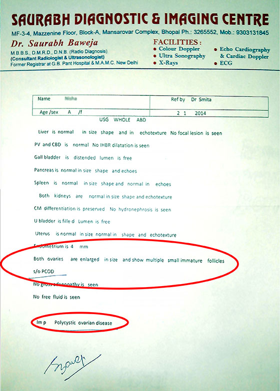 PCOS Ovary disease cured by Homeopathy | dr.nambisons.com