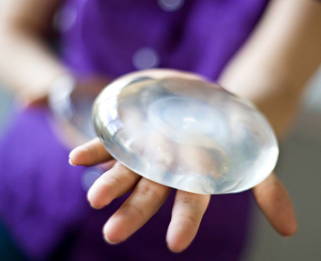 El raro cáncer asociado a los implantes de seno - Dr. Javier Cossio ...