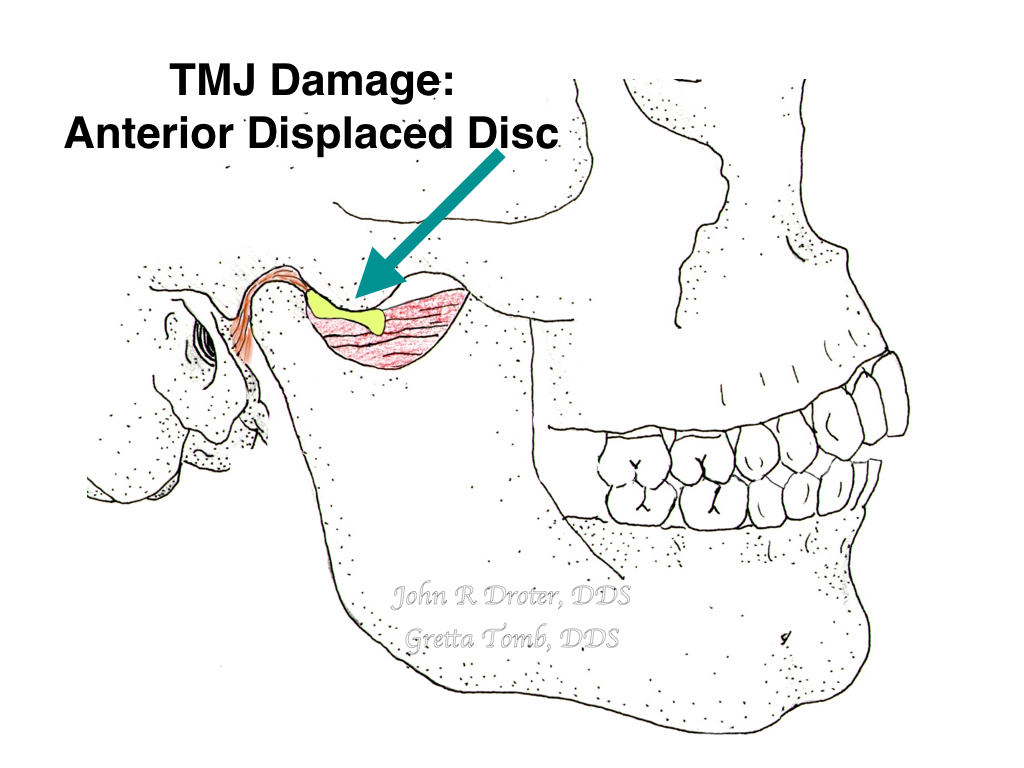 John R. Droter, DDS | Facial Pain Diagnosis and Treatment