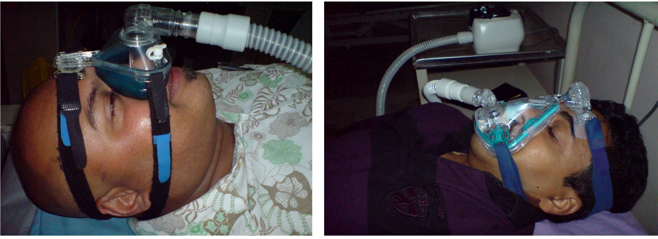 CPAP Dependency in OSA Patients | Dr Paulose