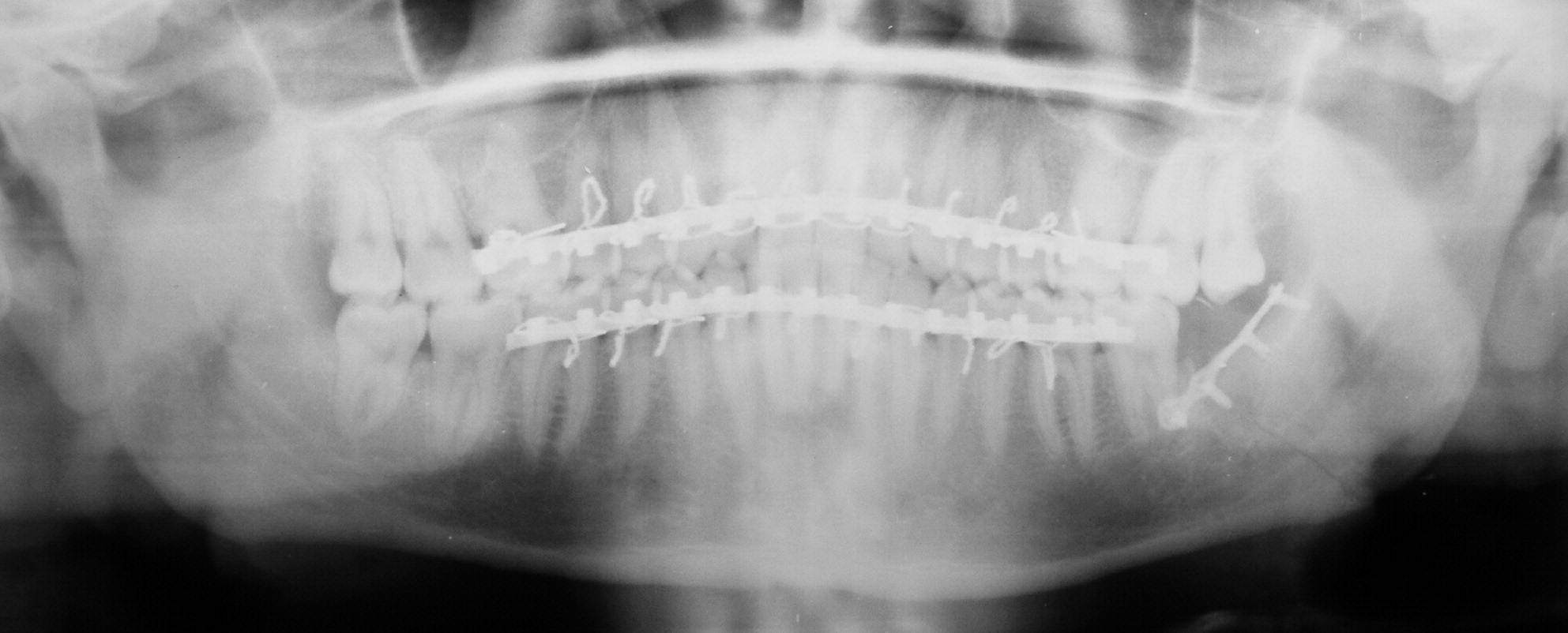 Facial Trauma - Dr. Jonathan Threadgill DMD, FACS