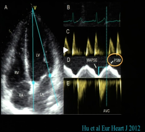 Mapse Echo Urgences 6799