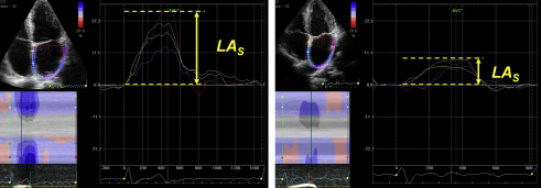 25 25-03:00 junho 25-03:00 2014 - EchoTalk Echocardiography