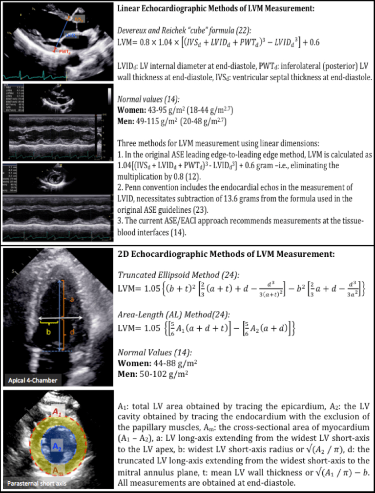 C lculo Da Massa Ventricular Ecocardiografia Define EchoTalk c-lculo-da-massa-ventricular-ecocardiografia-define-echotalk