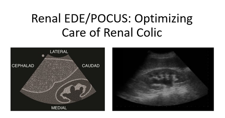 Renal POCUS/EDE presentation from EMU 2021 & NOVEC 2021 : EDE Blog