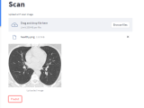 Building A Custom Cnn Model Identification Of Covid 19