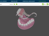 Removable Partial Dentures Ehuman