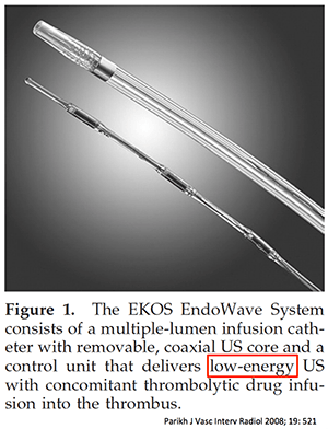 PulmCrit- Ultrasound-assisted thrombolysis of PE works. The question is ...