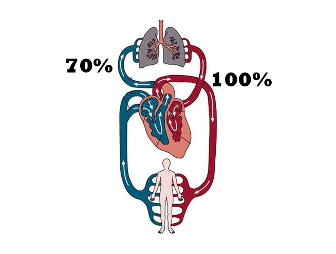 EMCrit 189 - Secret Sixth Cause of Arterial Hypoxemia and Vasoactive Purity