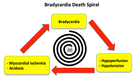 PulmCrit- Epinephrine vs. atropine for bradycardic periarrest