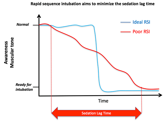 PulmCrit- Rocketamine vs. keturonium for rapid sequence intubation
