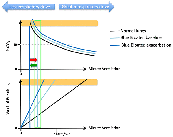 PulmCrit - Optimizing the respiratory drive to avoid failure