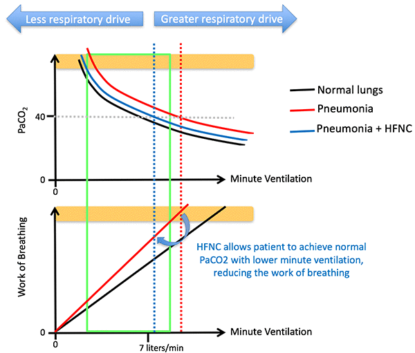 PulmCrit - Optimizing the respiratory drive to avoid failure