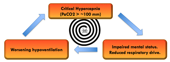 PulmCrit - Optimizing the respiratory drive to avoid failure