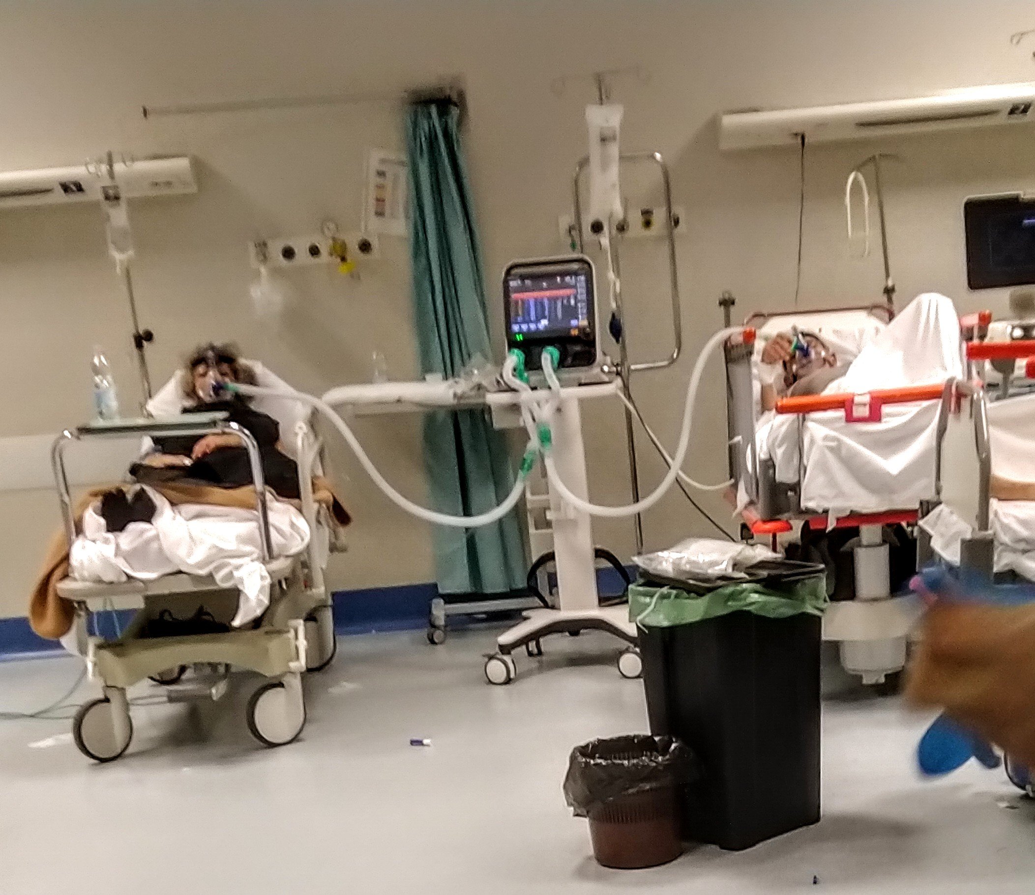 EMCrit Wee - Alternatives to Vent Splitting and the Safest Vent ...