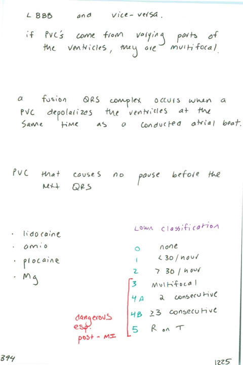 394. An RV source for a PVC results in what morphology QRS? / What is a ...