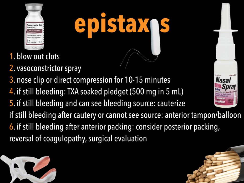 Management of Epistaxis – emupdates