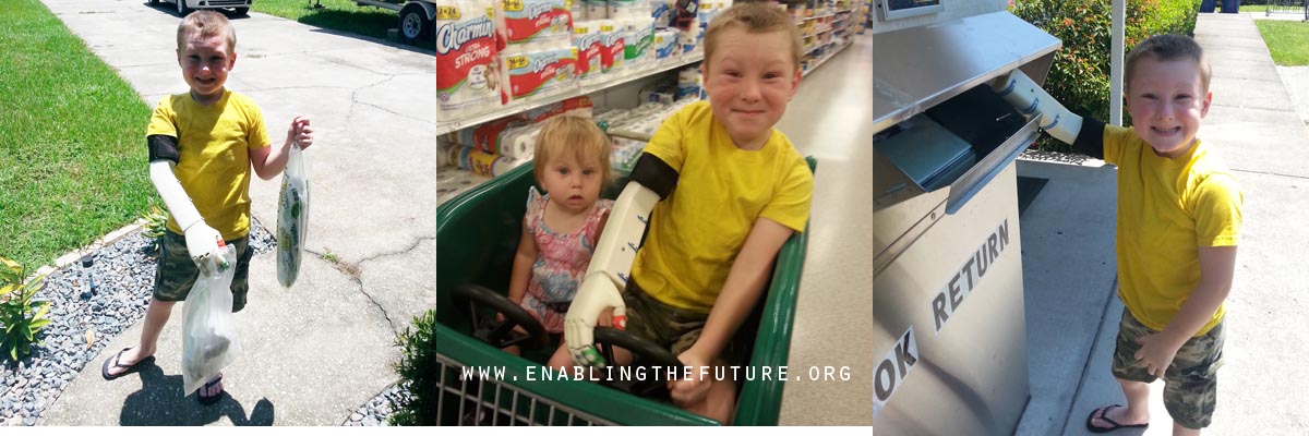 e-NABLING Alex – Enabling The Future