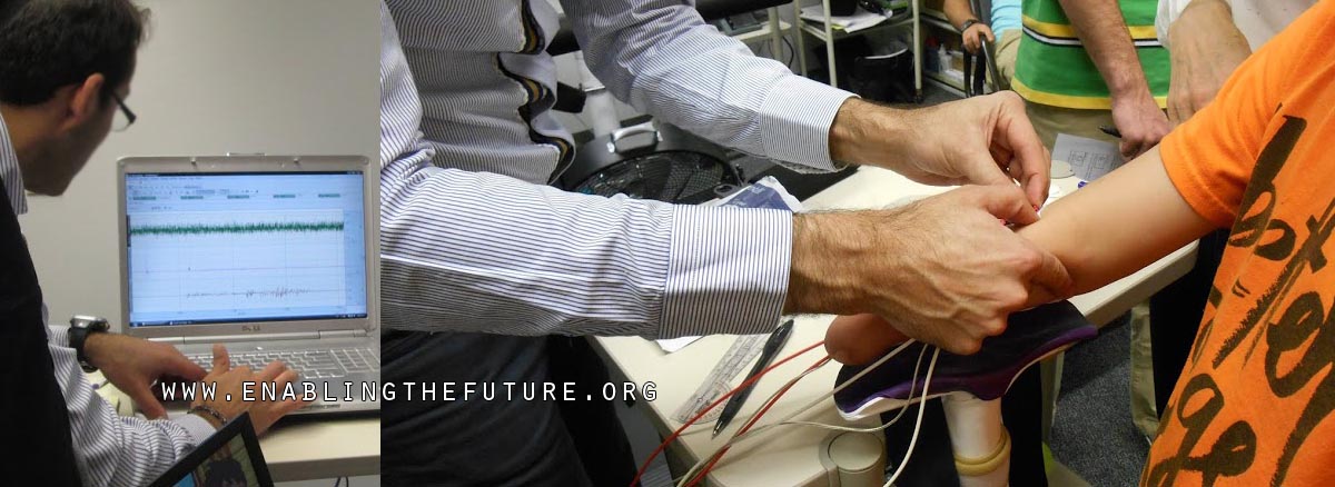 3D Printed Prosthetics Study – e-NABLE Hands At Creighton University – Enabling The Future