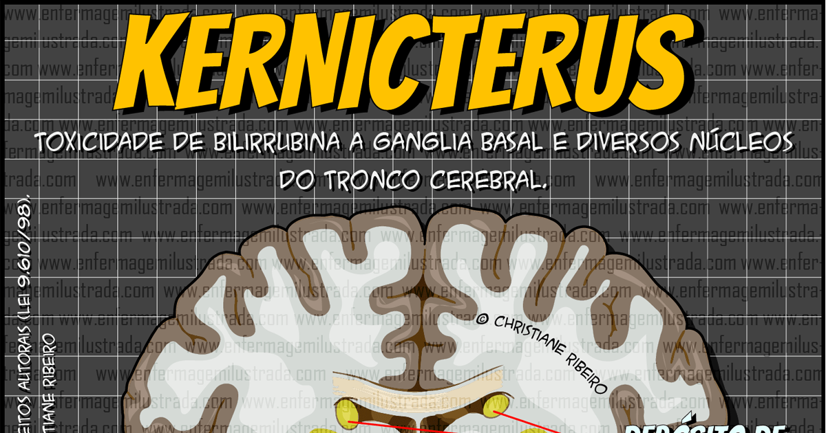 Kernicterus - Enfermagem Ilustrada