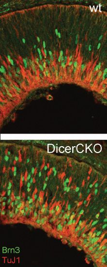 8 Retinal Development | Ento Key