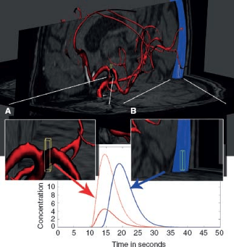 Arterial Input Function And Venous Output Function Ento Key 7713