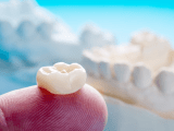 Are You Missing One Or More Teeth Angela Evanson Dds In Parker Co